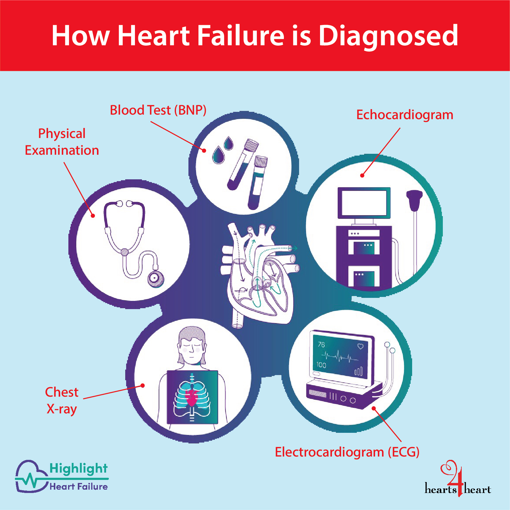 Heart Failure Awareness Week (19-25 June, 2023) – Hearts4heart