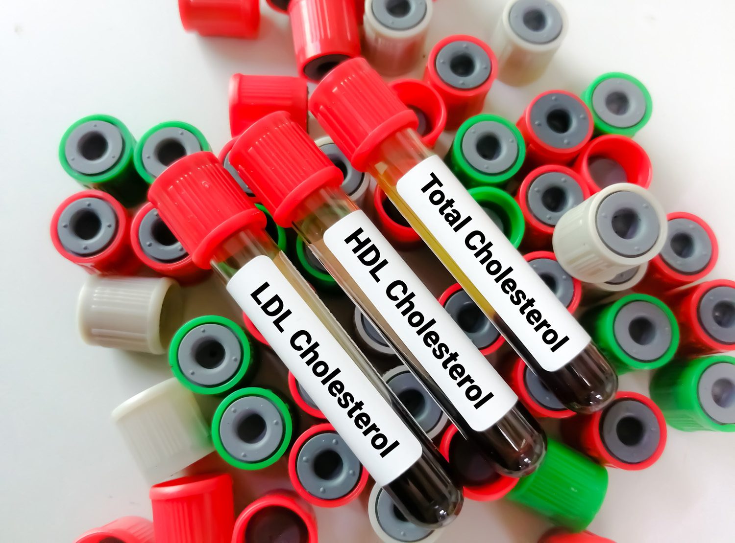 ATHEROSCLEROTIC CARDIOVASCULAR DISEASE - Hearts 4 Heart